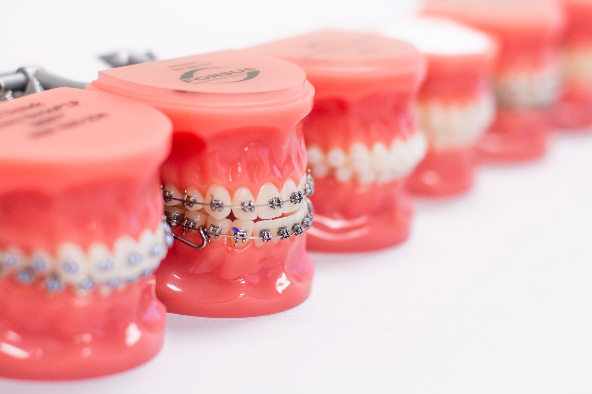 Northport Braces | Braces Northport | Cowan & Whitaker Orthodontics Northport Braces | Braces Northport | Cowan & Whitaker Orthodontics